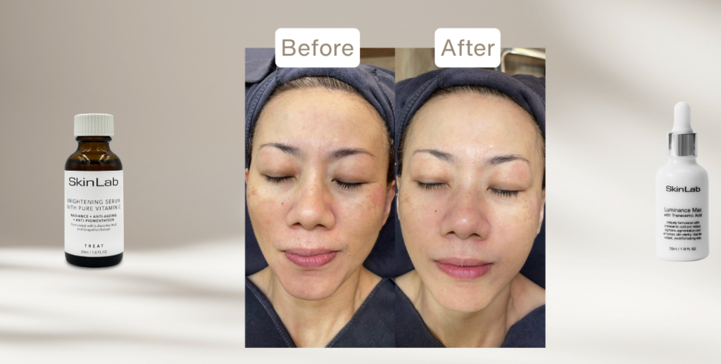 Best product for pigmentation store